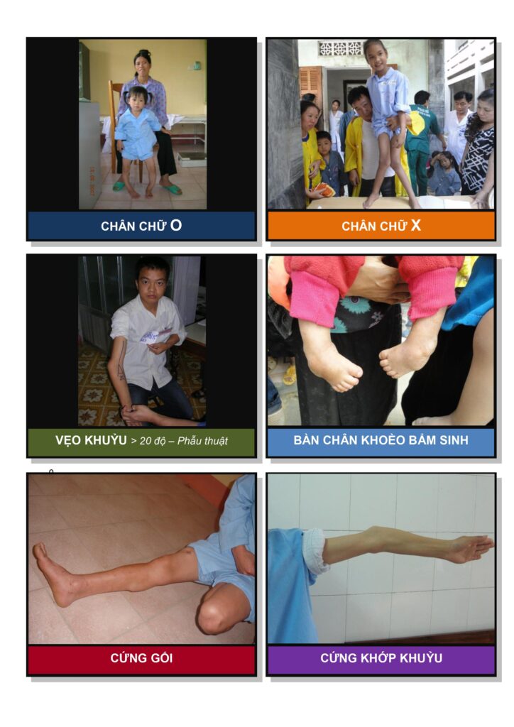 Nhận dạng trẻ khuyết tật có nhu cầu phẫu thuật Trung tâm II – Địa chỉ ...